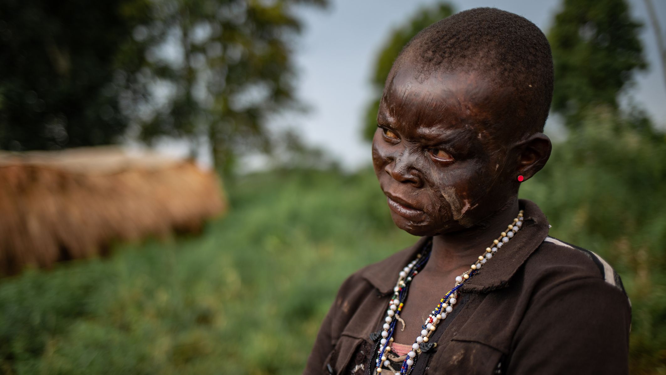 The worlds most neglected displacement crises in 2020
